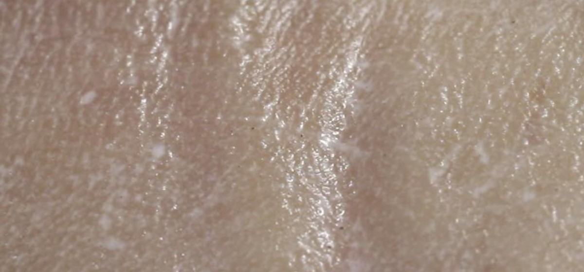 Crispy Roasted Pork Belly 脆皮燒肉 Recipe | SideChef